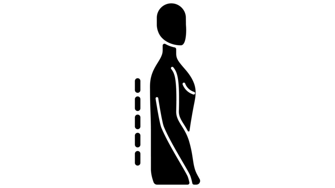 Types of Posture & Postural Deformities | Expert Guide