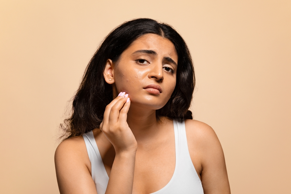 Is There a Way to Get Rid of Period Acne? | MFine