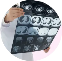 Full Body Checkup Packages starting @ 499/- | MFine